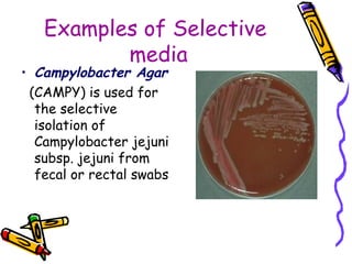 Media in microbiology | PPT