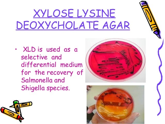 Xylose Lysine Deoxycholate Xld Agar Principle Uses