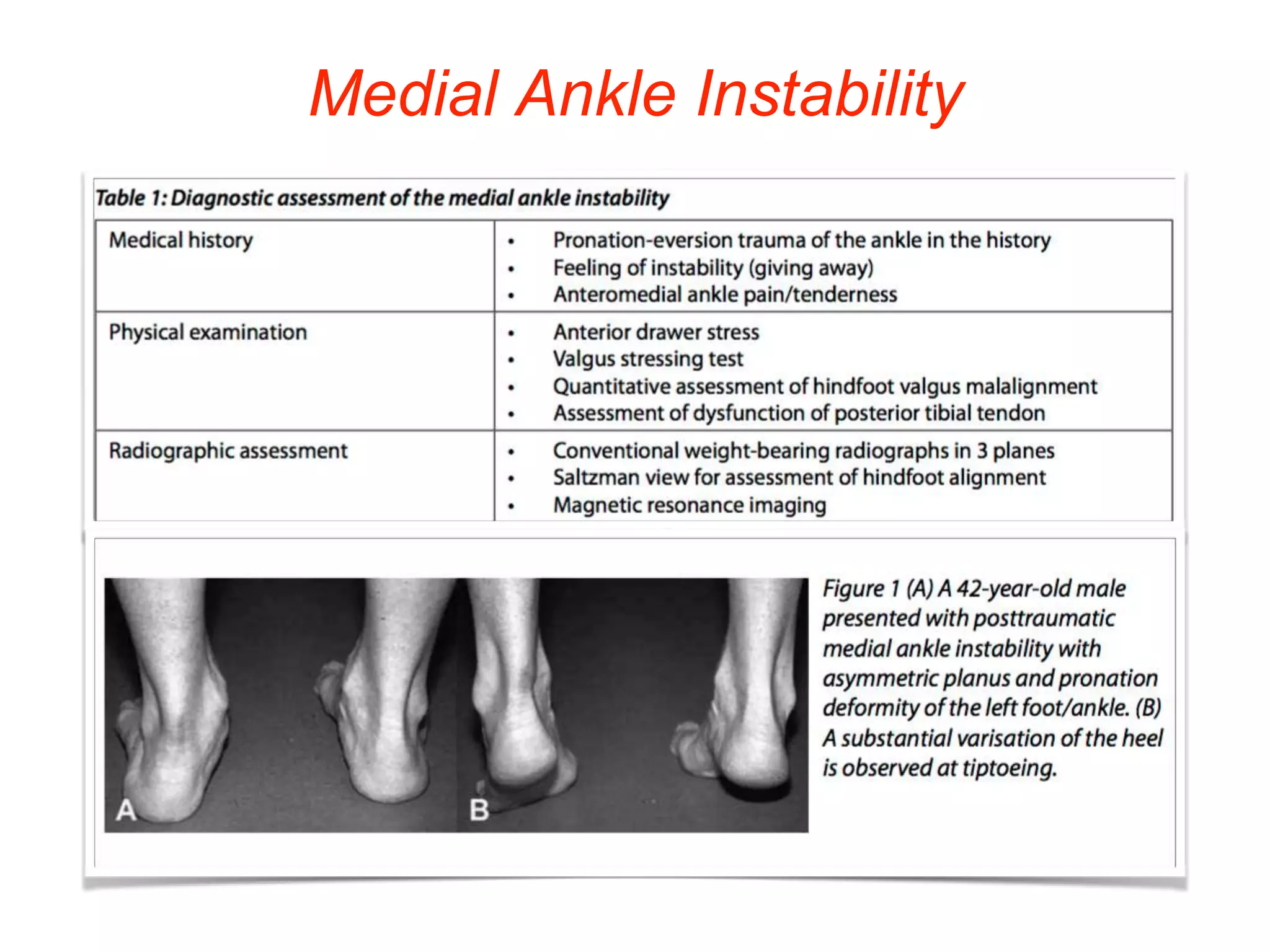 Medial ankle pain | PPT