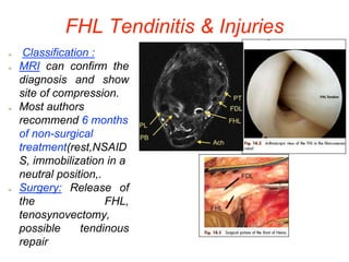 Medial ankle pain | PPTX