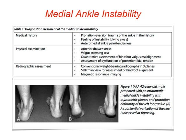 Medial ankle pain | PPT