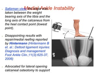 Medial ankle pain | PPT
