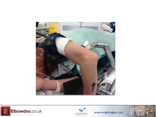 Medial approaches elbow