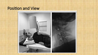 Cervical spine Medial branch block procedure | PPTX