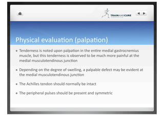 Medial calf muscle rupture | PDF