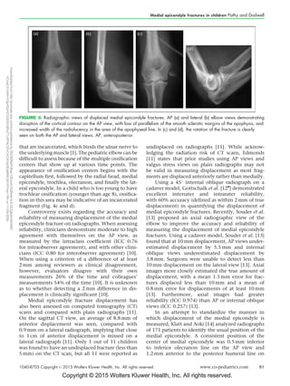 medial_epicondyle_fractures_in_children.10.pdf