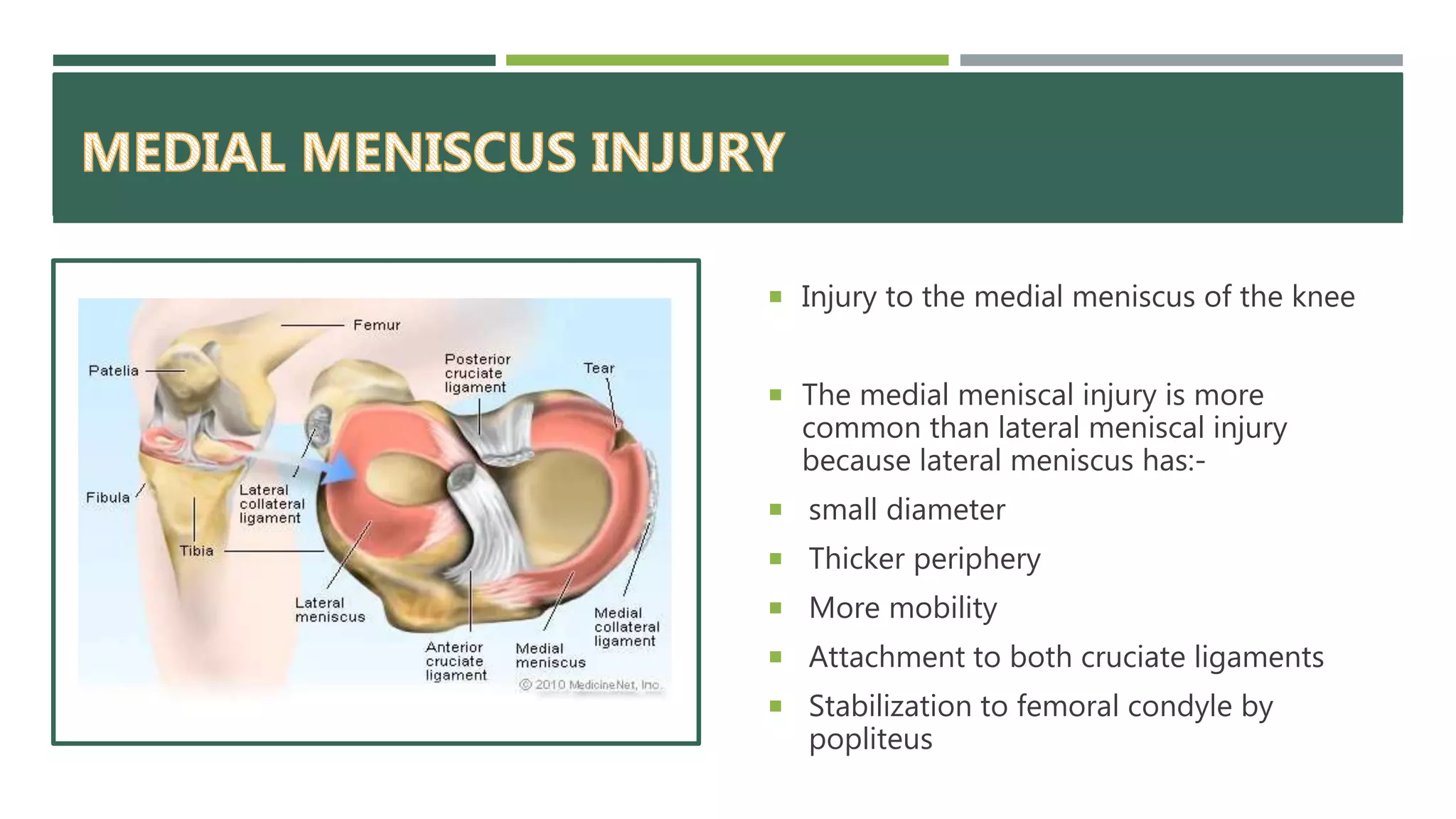 Medial meniscus injury and physiotherapy treatment @Dr.Muskan Rastogi ...