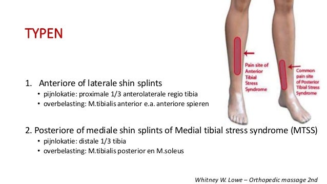 Medial tibial stress syndrome (MTSS)