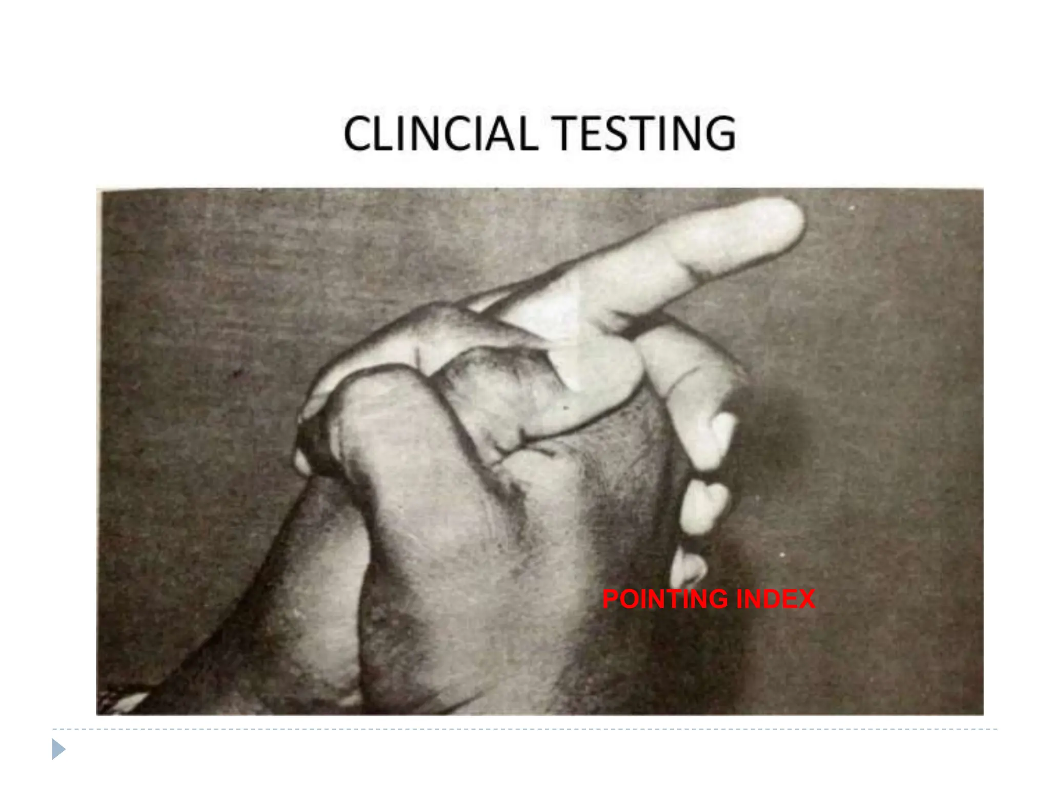 ANATOMY OF MEDIAN AND ULNAR NERVE AND APPLIED ANATOMY | PPT