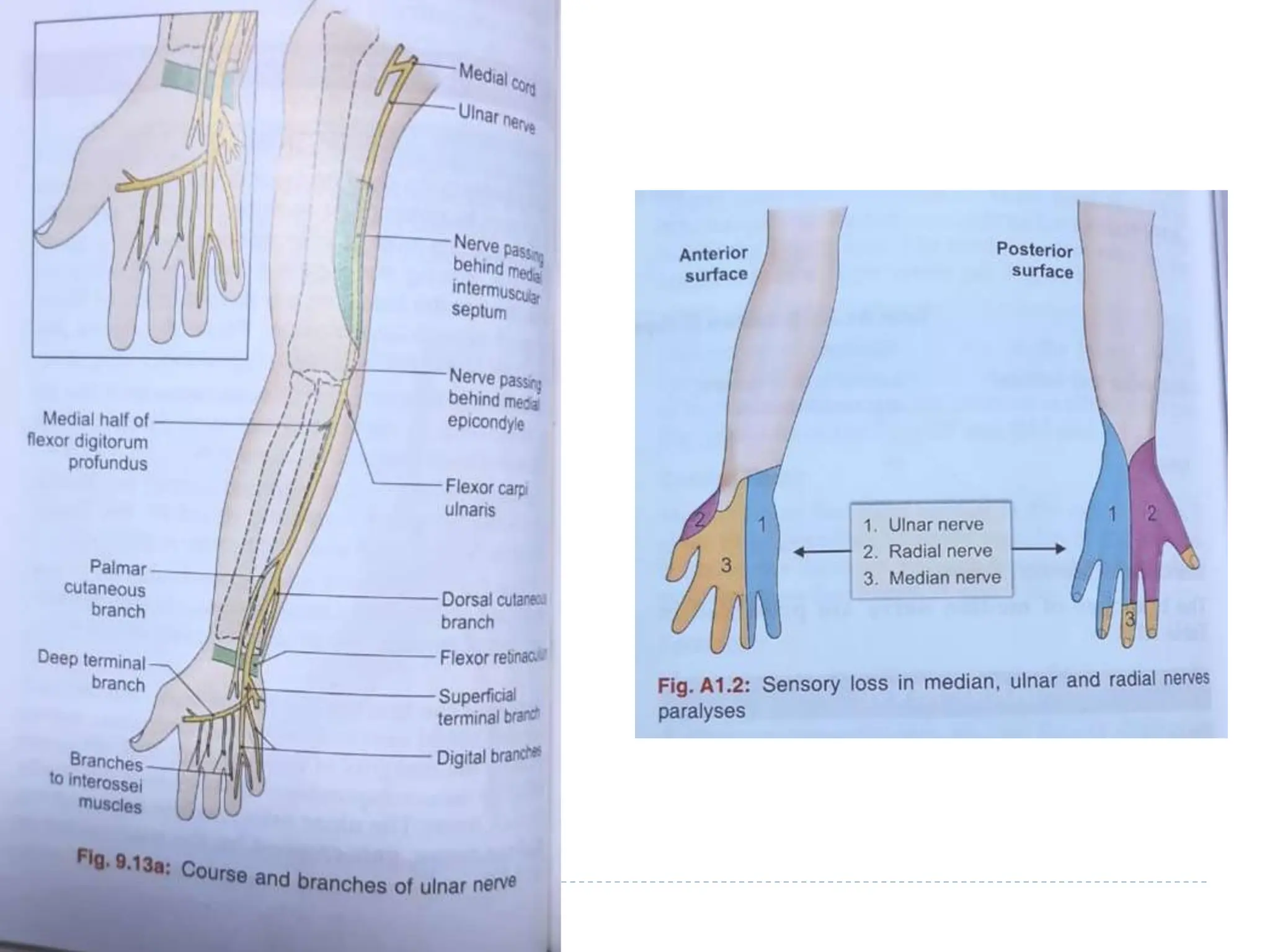 ANATOMY OF MEDIAN AND ULNAR NERVE AND APPLIED ANATOMY | PPT