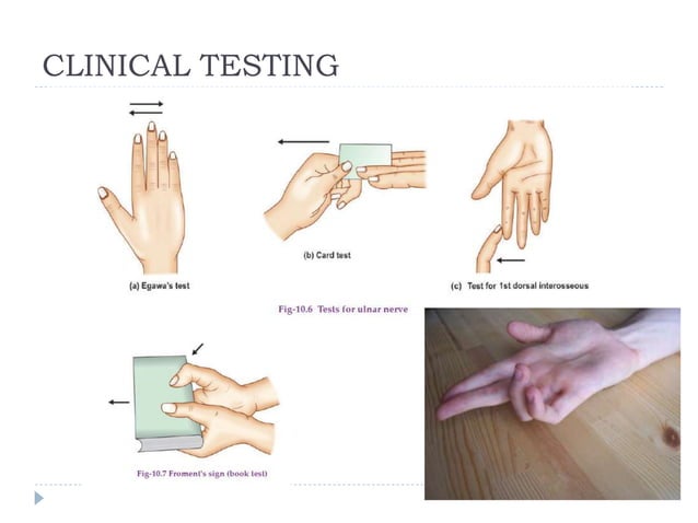 ANATOMY OF MEDIAN AND ULNAR NERVE AND APPLIED ANATOMY | PPT