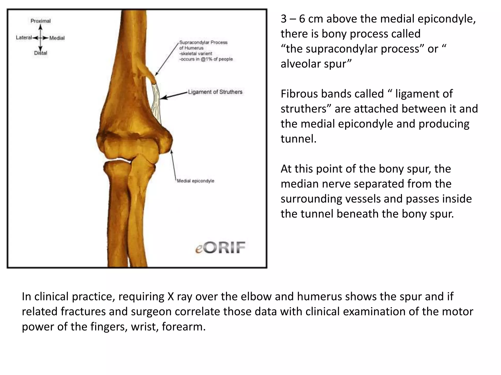 Median median anatomy carpal tunnel syndrome.pptx