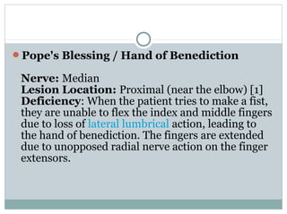Popes Blessing Hand Median Nerve