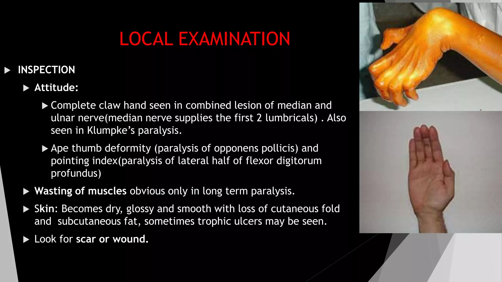 EXAMINATION OF MEDIAN NERVE FOR MBBS UNDERGRADUATES ORTHO | PPTX