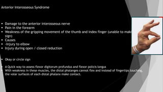 EXAMINATION OF MEDIAN NERVE FOR MBBS UNDERGRADUATES ORTHO | PPTX