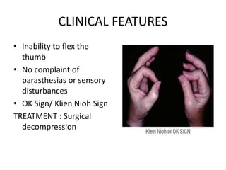 Median nerve | PPTX
