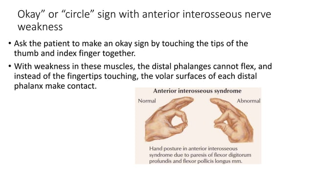Median nerve injury | PPTX