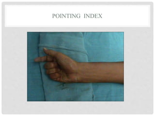 Median nerve.pptx
