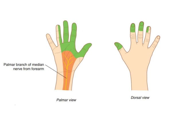 Median Nerve.pptx