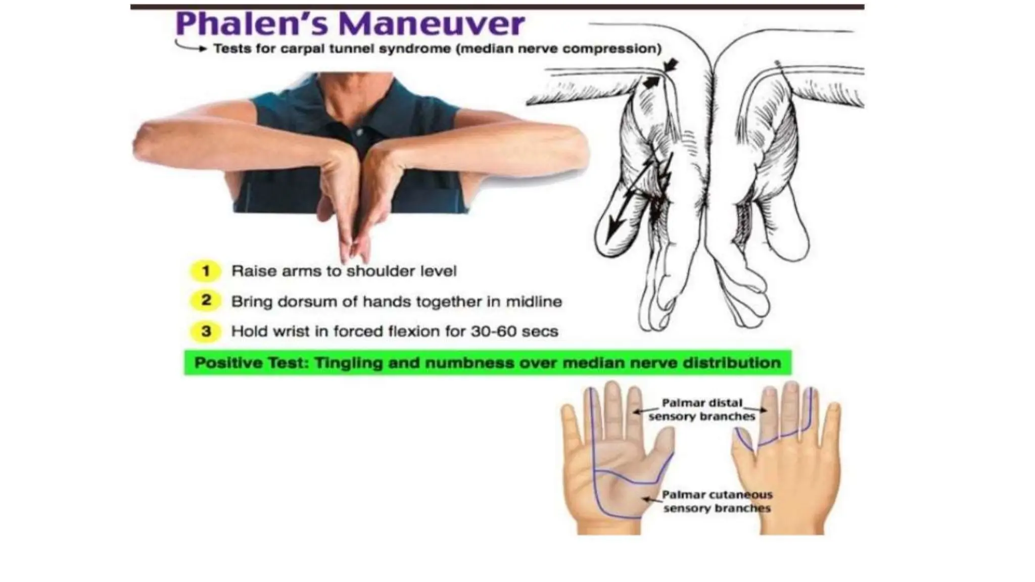 median nerve power point presentation.pptx