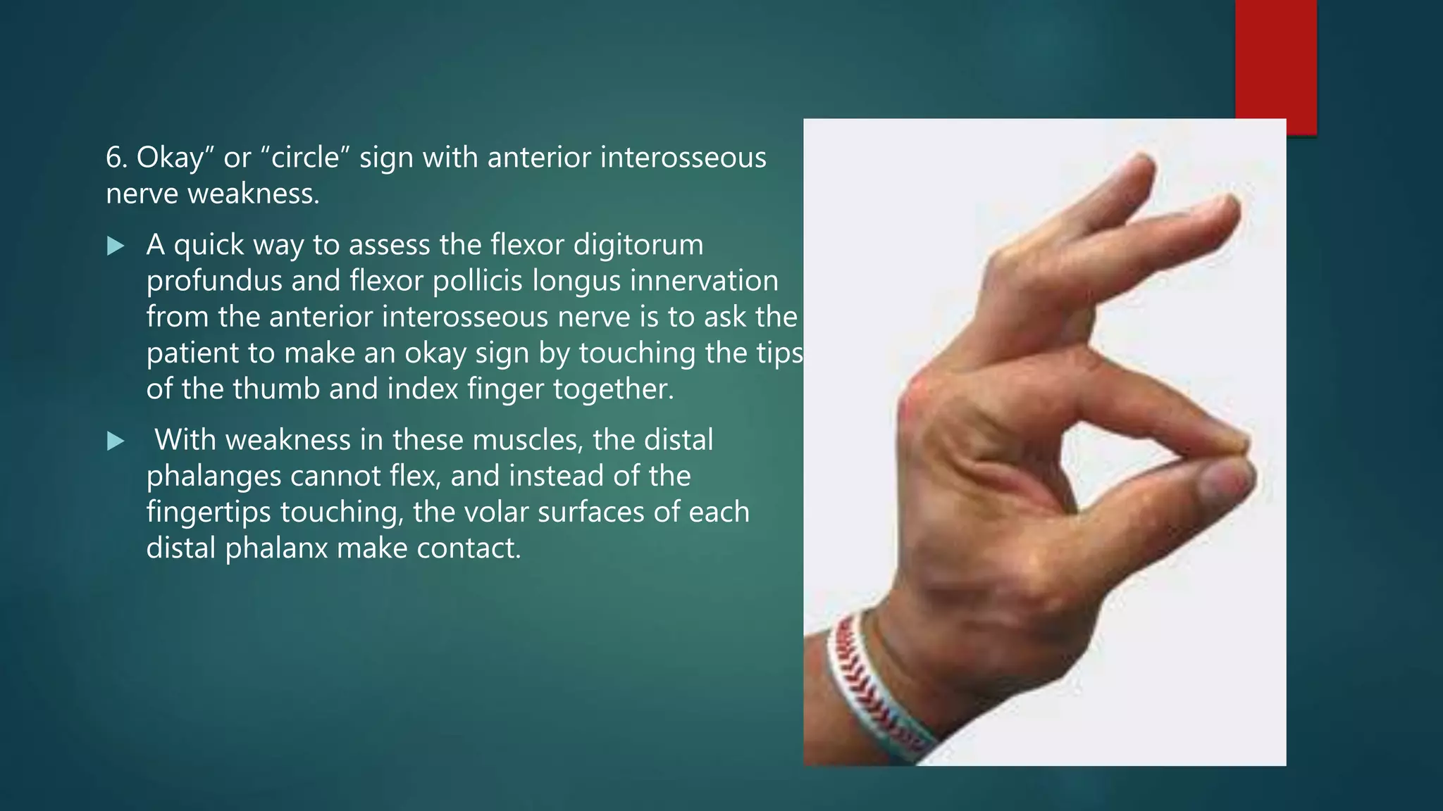 Median nerve injuries | PPTX