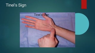 median nerve injuries.pptx | Death, Injury, or Military Conflict ...