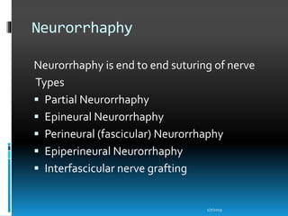 Median nerve injury | PPTX