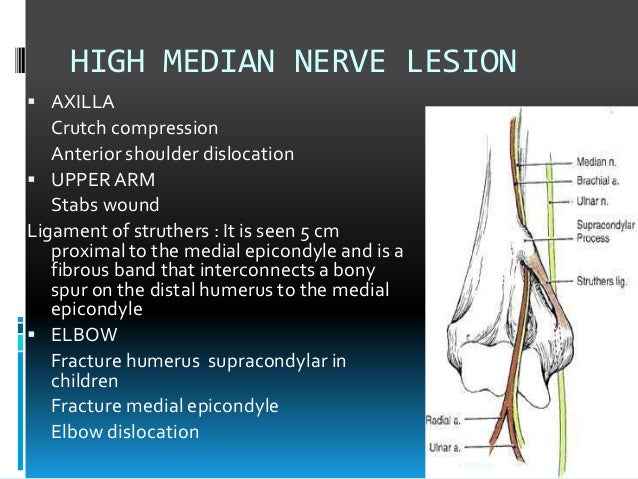 Median Nerve Pain Symptoms