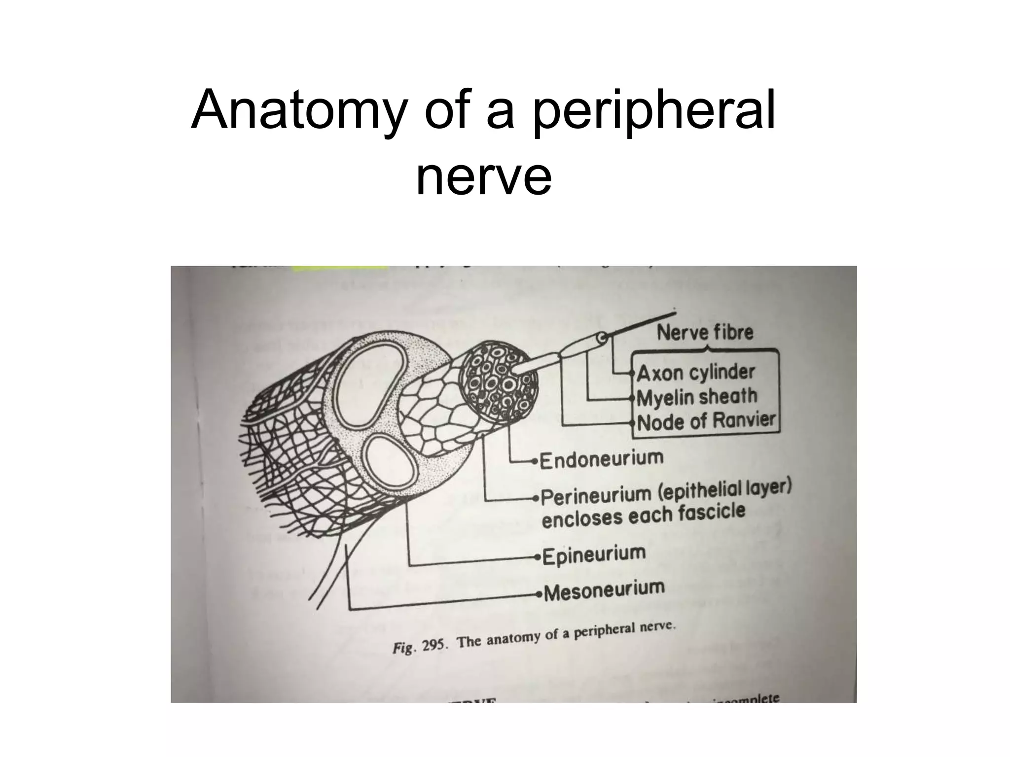 seminar Median nerve injury | PPTX