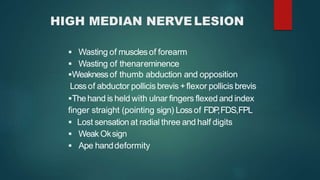 Median nerve palsy | PPTX