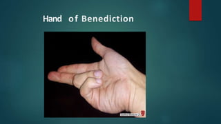 Median nerve palsy | PPTX