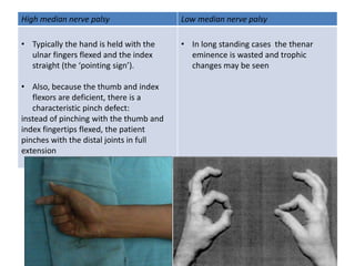 Median nerve palsy final | PPTX