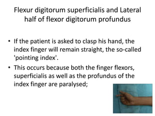 Median nerve palsy final | PPTX