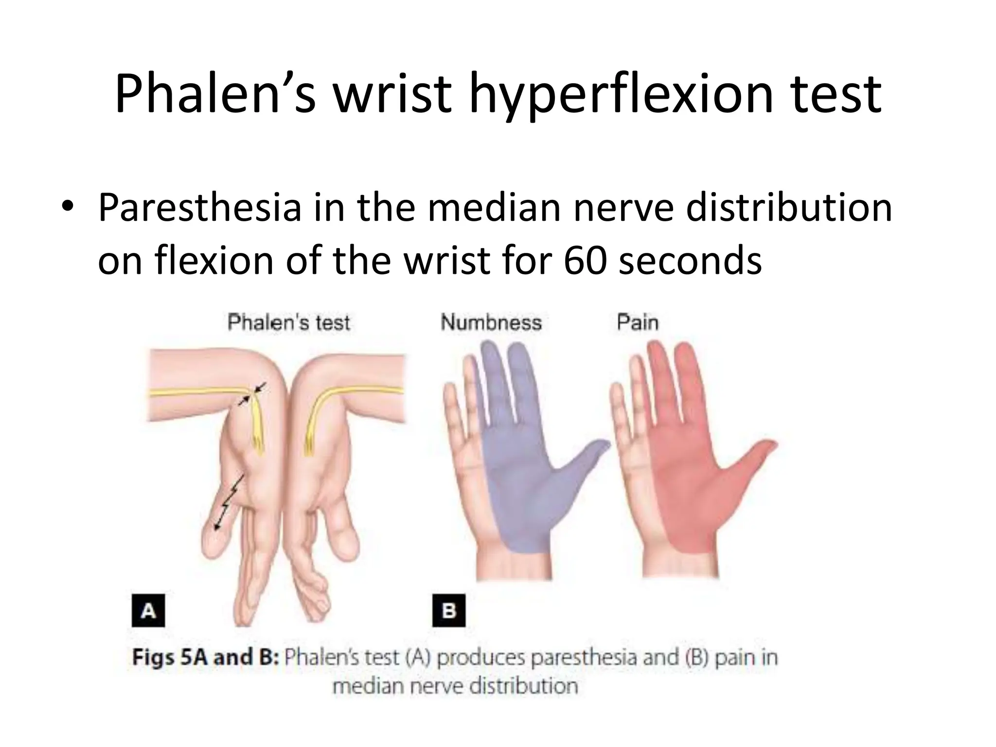 MEDIAN NERVE PRESENTATION (2).pptx