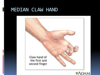 Anatomy of Median Nerve & Ulnar Nerve.pptx