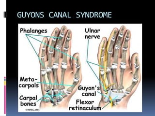 Anatomy of Median Nerve & Ulnar Nerve.pptx