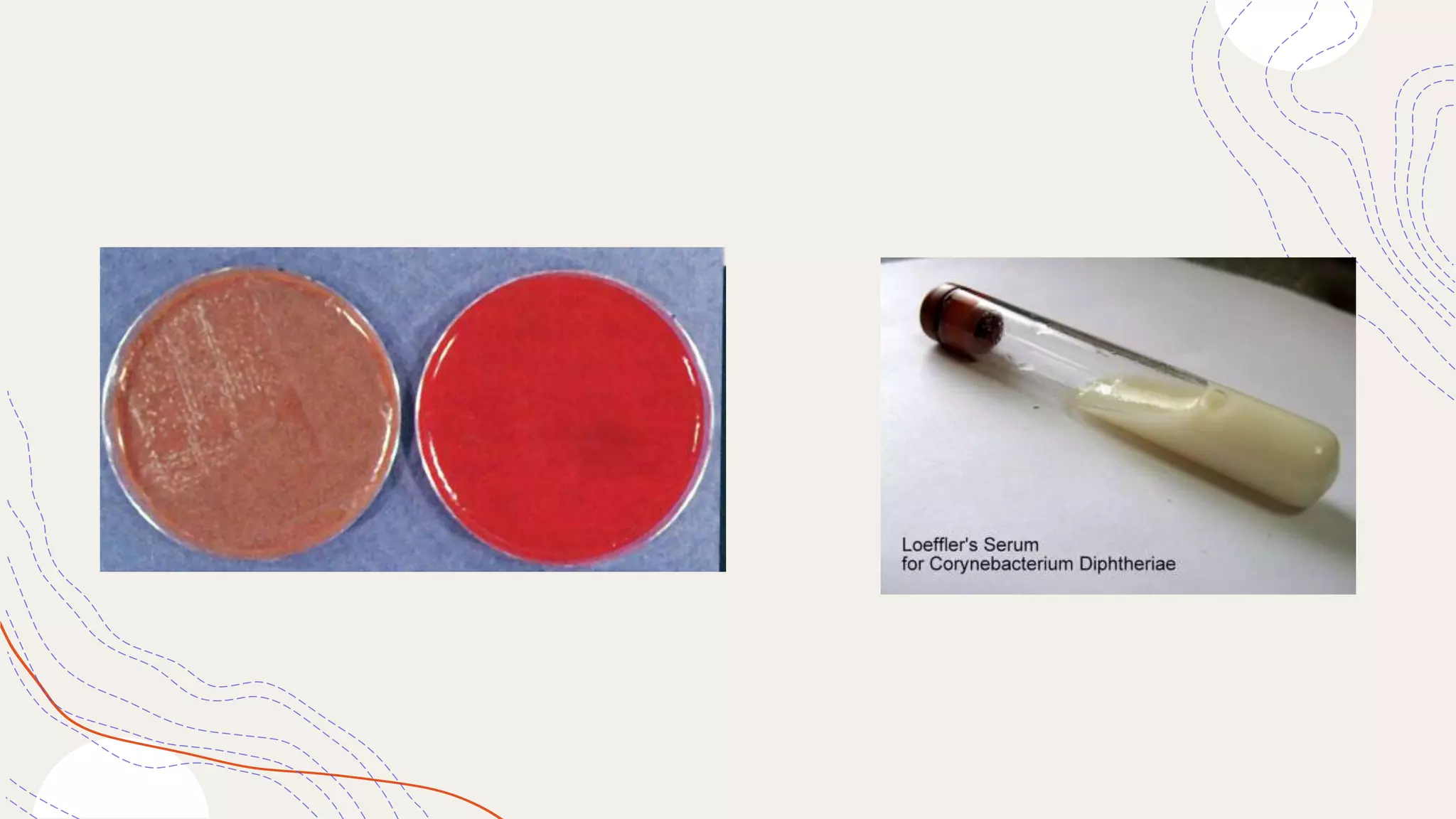 Preparation of bacterial culture media | PPTX