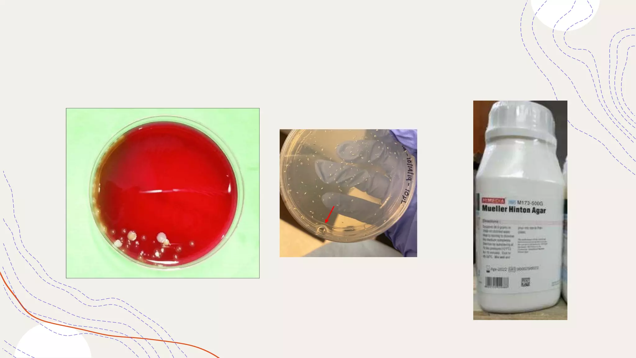 Preparation of bacterial culture media | PPTX