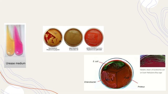 Preparation of bacterial culture media | PPTX