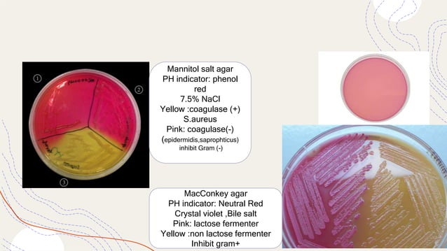 Preparation of bacterial culture media | PPTX