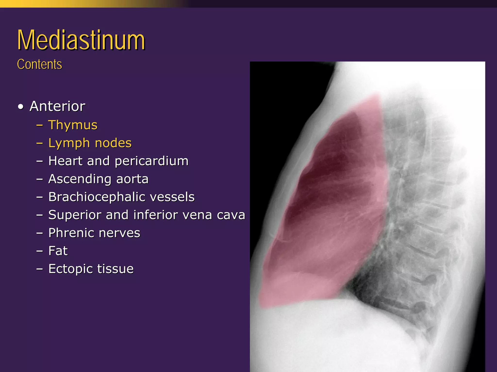 Mediastinal Pathology Compartmental Approach | PDF