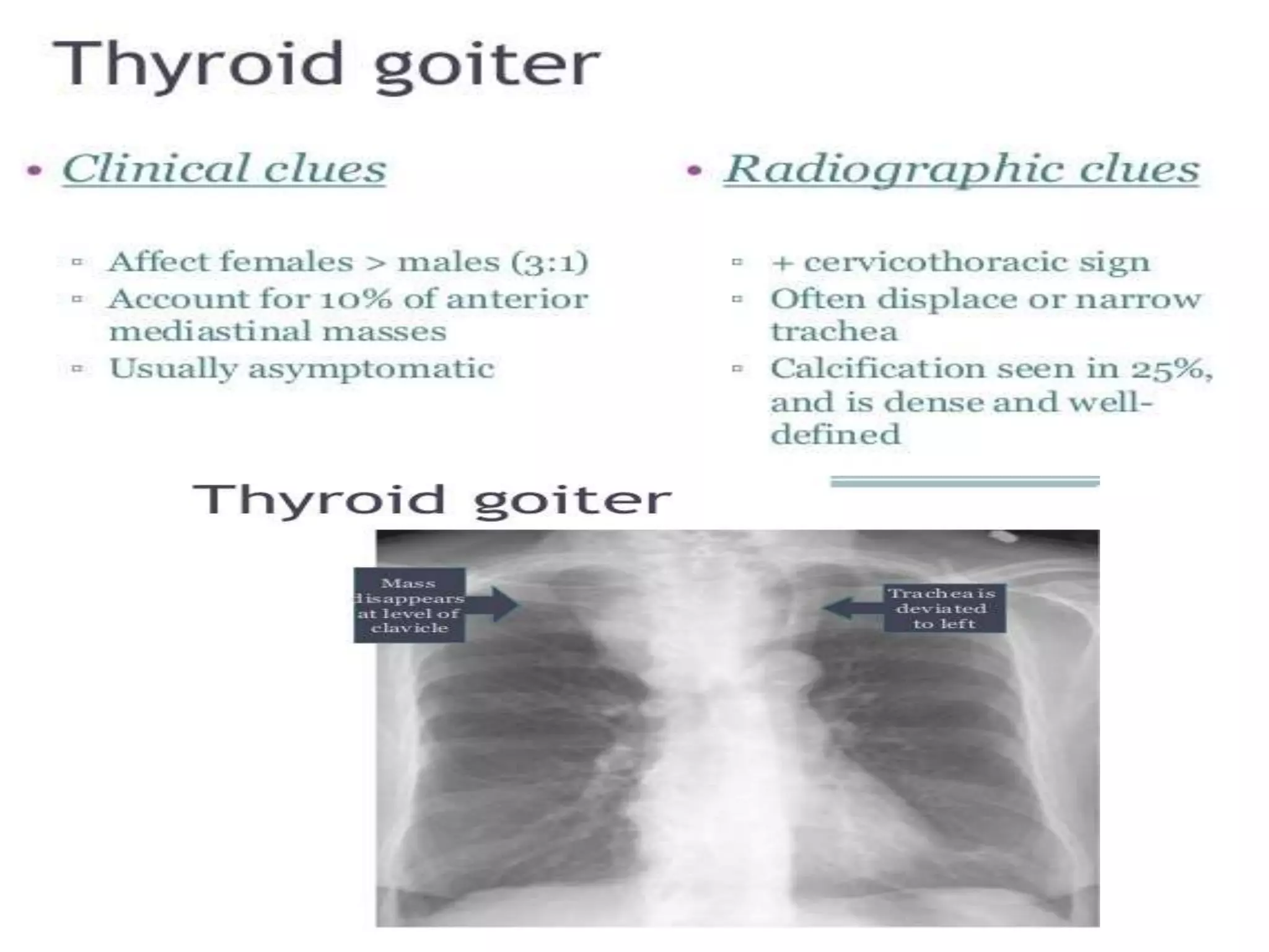 Mediastinal anatomy ,classification of mediastinal masses ans its ...