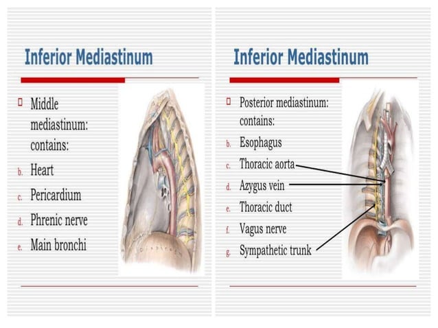 Mediastinal anatomy ,classification of mediastinal masses ans its ...