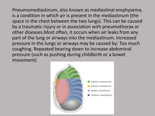 Mediastinal injury (PNEUMOMEdIASTINUM)- Bhadra.pptx