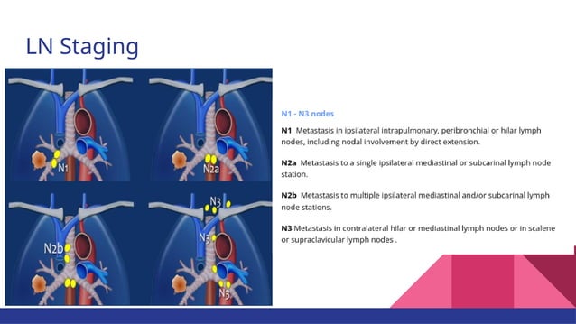 Current Evidences on Mediastinal Lymph Node Dissection for Lung Cancer ...