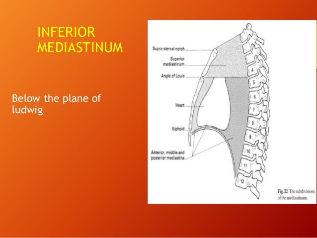 Mediastinal mass