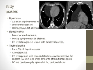 Mediastinal Mass dr dharma poonia | PPT