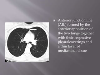 X RAY CHEST IN EVALUATION OF MEDIASTINAL MASSES | PPTX