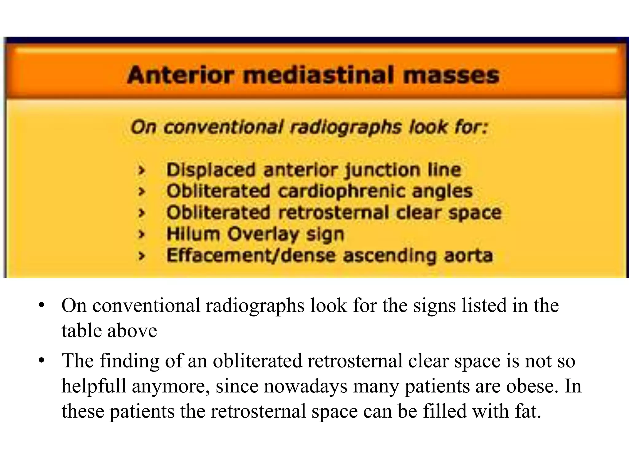 Imaging in mediastinal masses by Dr. Milan Silwal | PPT