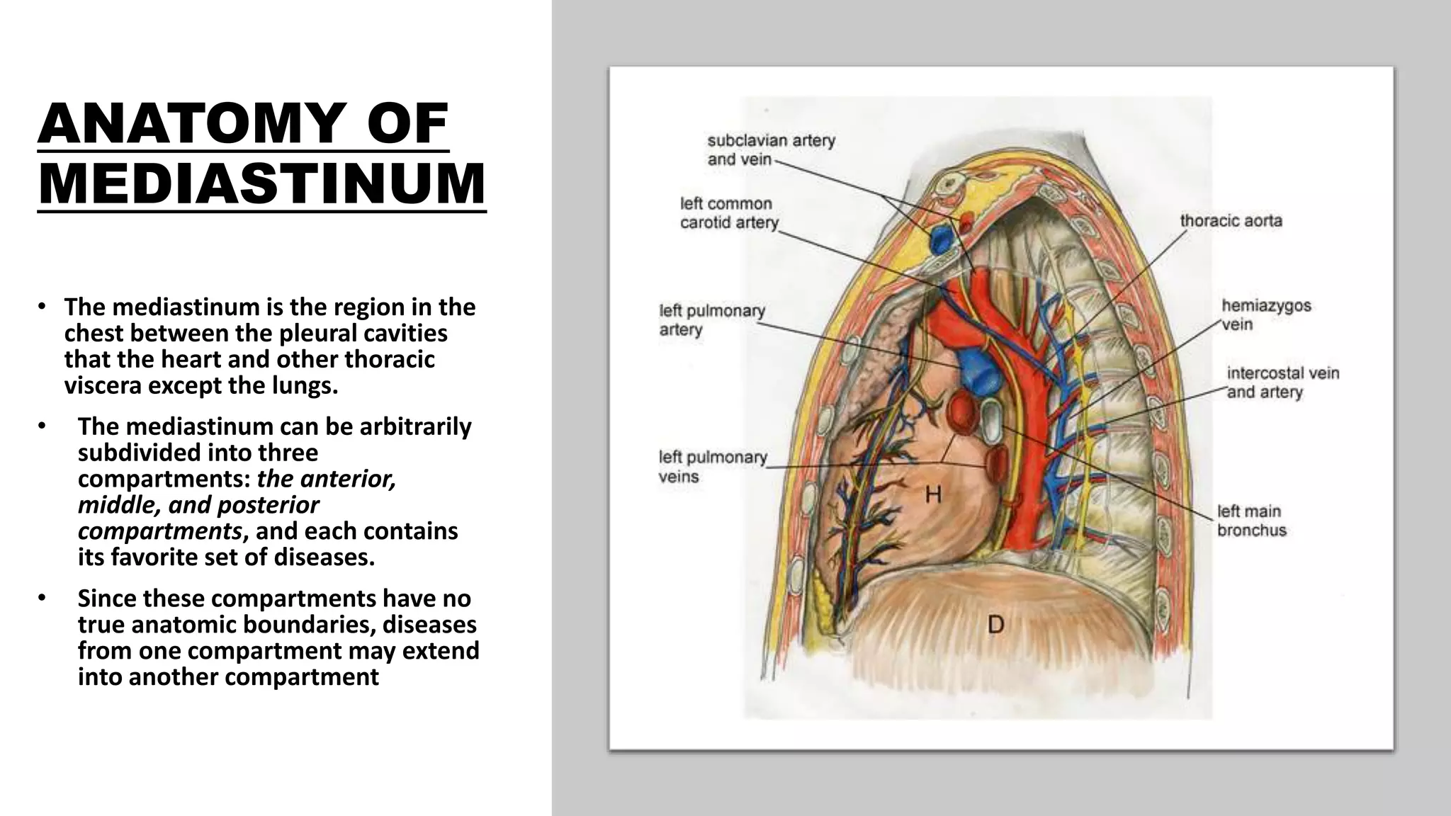 Radiological study on Mediastinal masses | PPTX